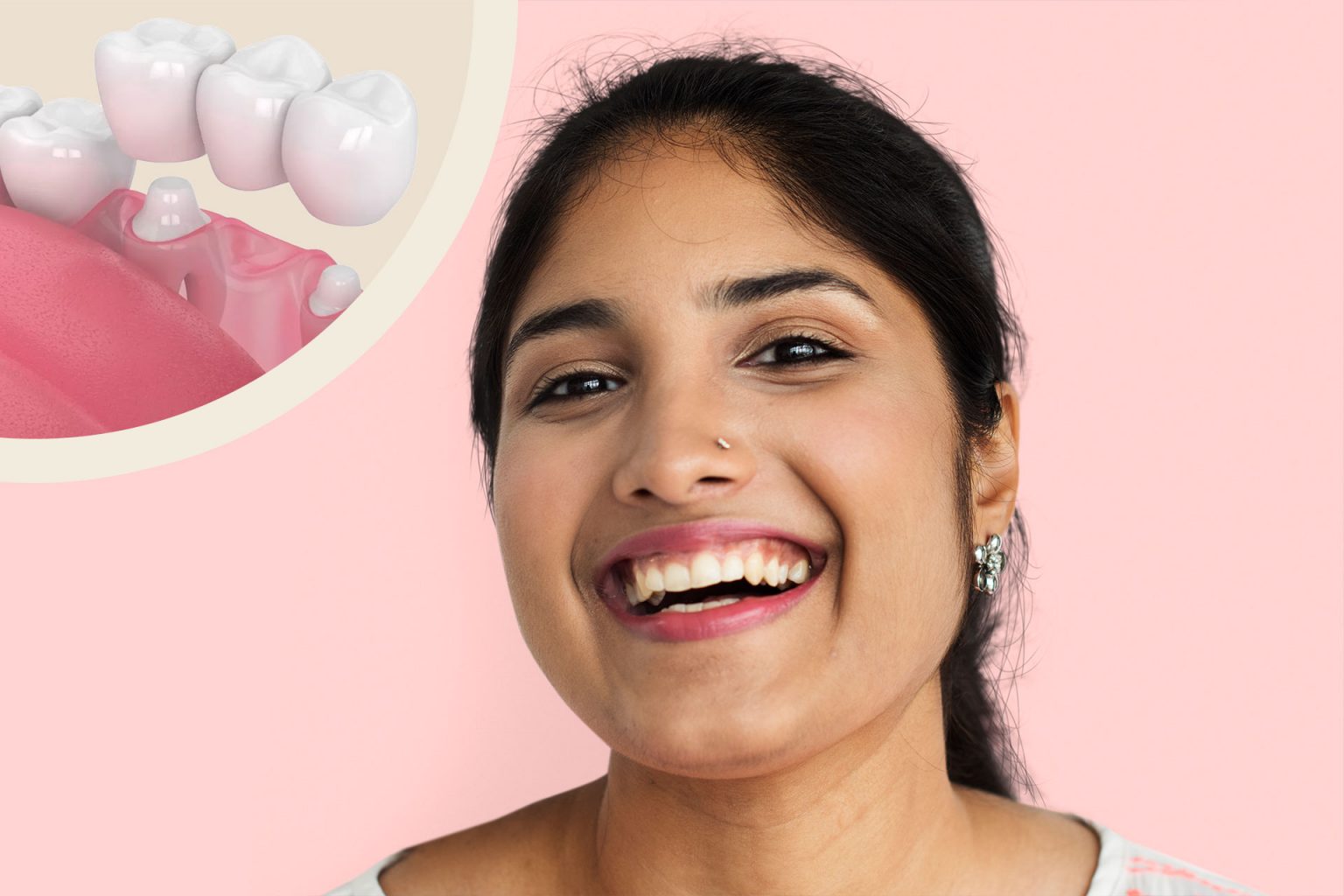 Our Services Smile Guyana Dental Services our-services-smile-guyana-dental-services